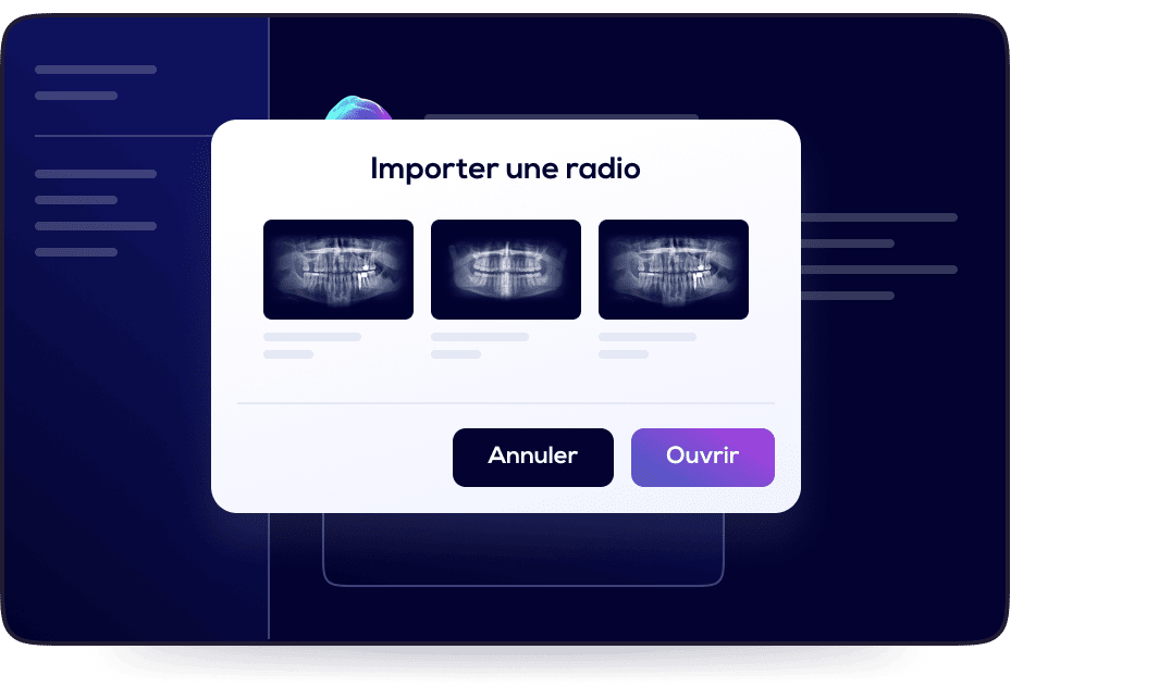 Allisone - El software para explicar sus radiografías dentales